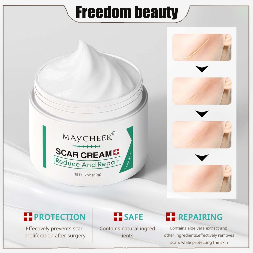 Scar Eliminator Cream Scar Remover Cream Miracle Cream Stretchmarks ...