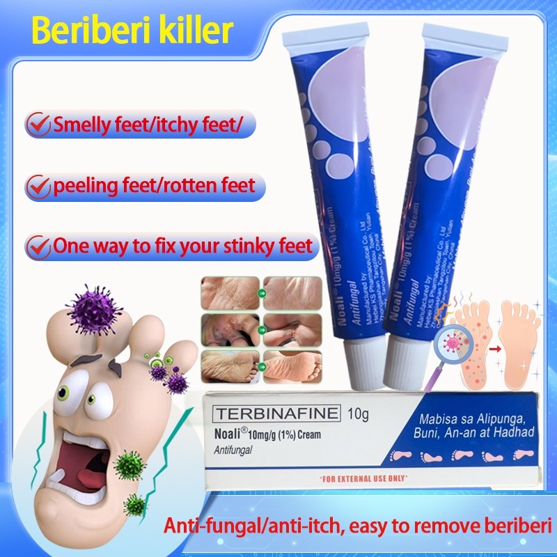 Terbinafine Noali Cream Effective for Buni, An-an, Hadhad and Alipunga ...