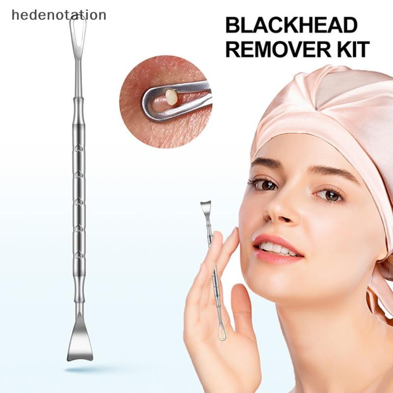 [hedenotation] 2 In 1 Pimple Popper Tool Blackhead Remover Acne ...