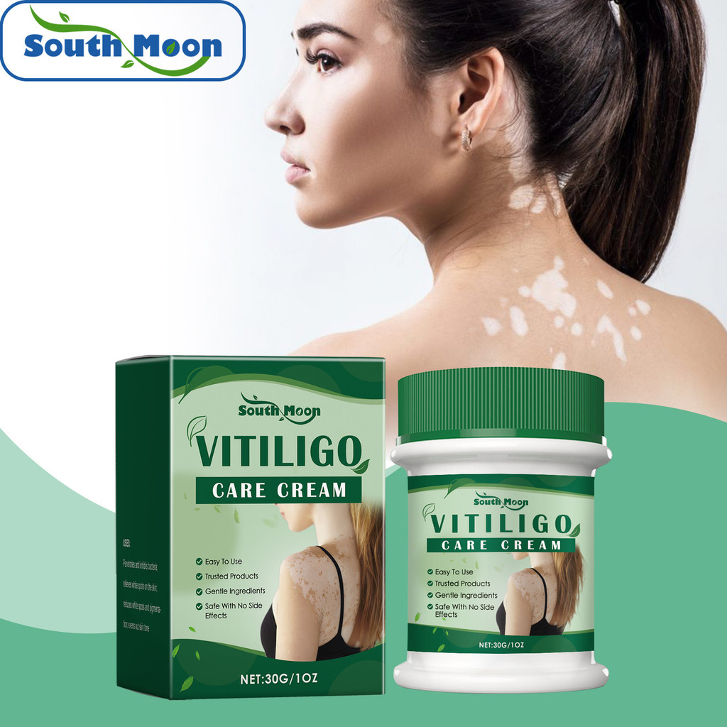 【in stock】Vitiligo Leukoplakia Treatment Cream Eliminate Ringworm Cure ...