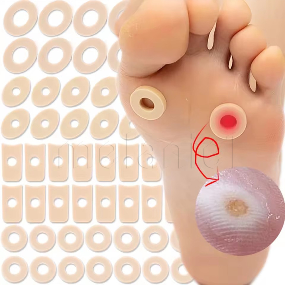 Foot Wart Corn Remover Sticker - Toe Foot Corn Bunion Protectors - Feet ...