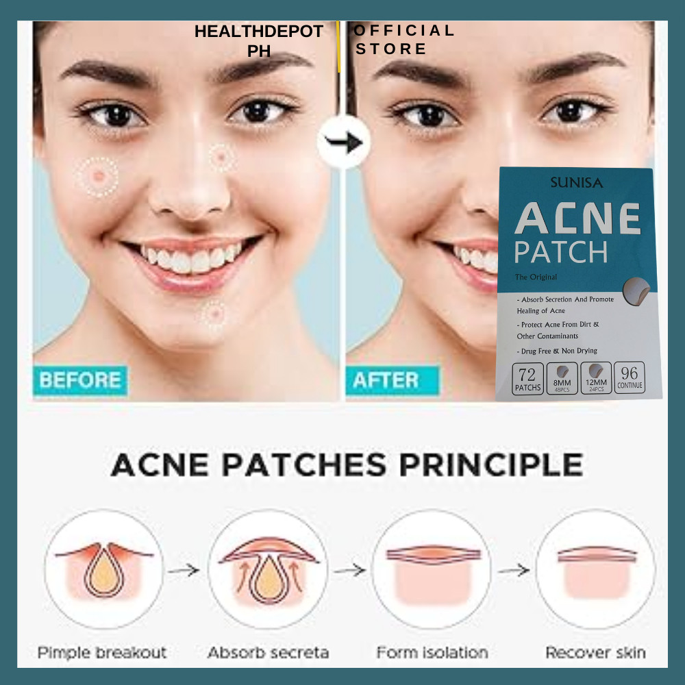 72P Sunisa Acne Patch Salicylic Pimple Patch Blemish Treatment Skin ...