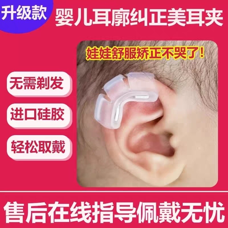 Ear Brace Baby Newborn Child Auricle Silicone Ear Brace Lop-Ear Wind ...