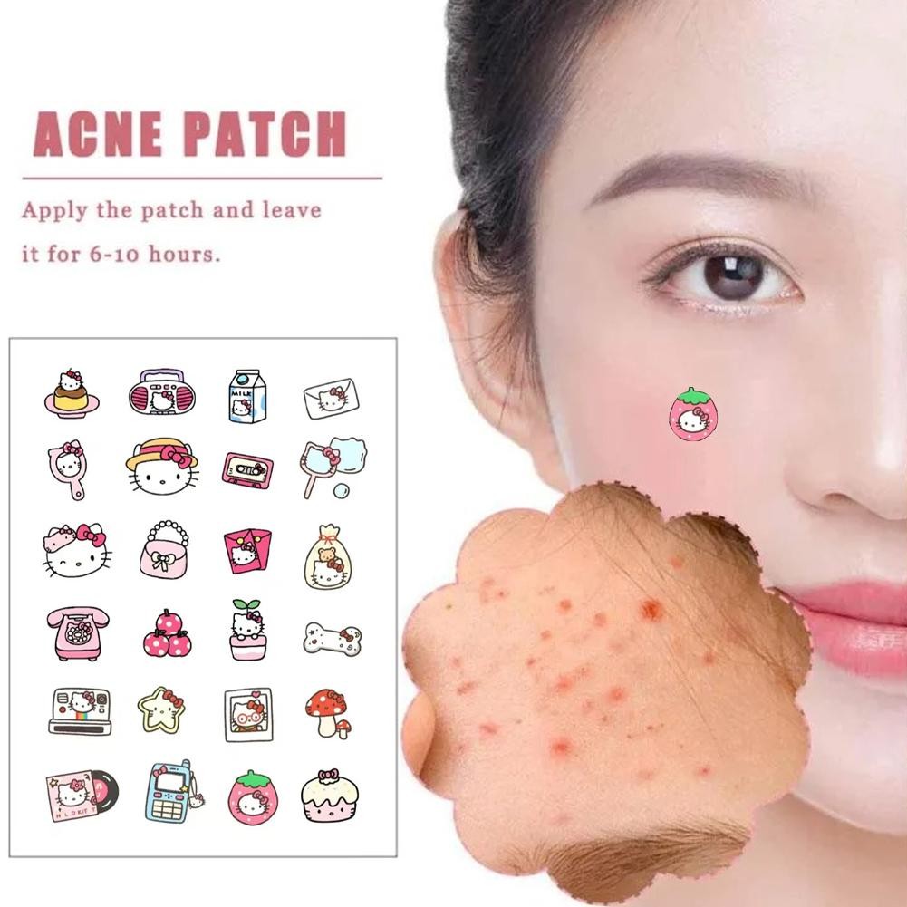 Cartoon Cat Acne Sticker Mild And Non-irritating Acne Sticker Skin Care ...