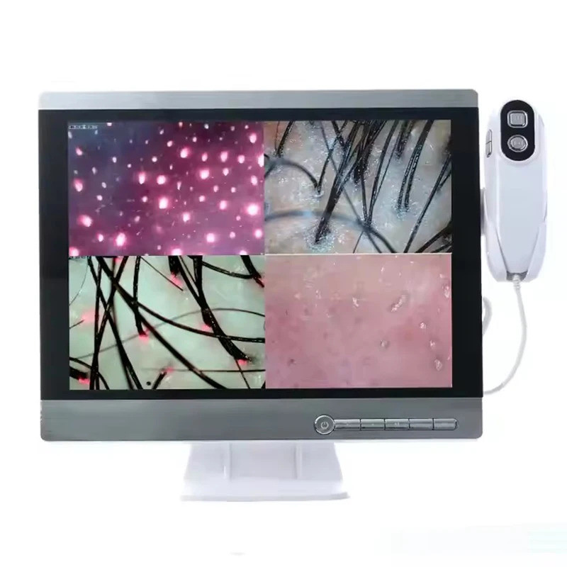 2025 NEW 15inch HD Professional Hair Follicles Scalp Detector Digital ...