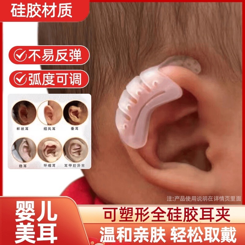 Newborn Silicone Ear Brace Built-in Orthopedic Infant Deformity Auricle ...