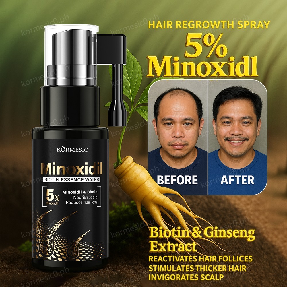 KORMESIC 5% Minoxidil Biotin Hair Growth Spray 30ml - DHT Blocker for ...