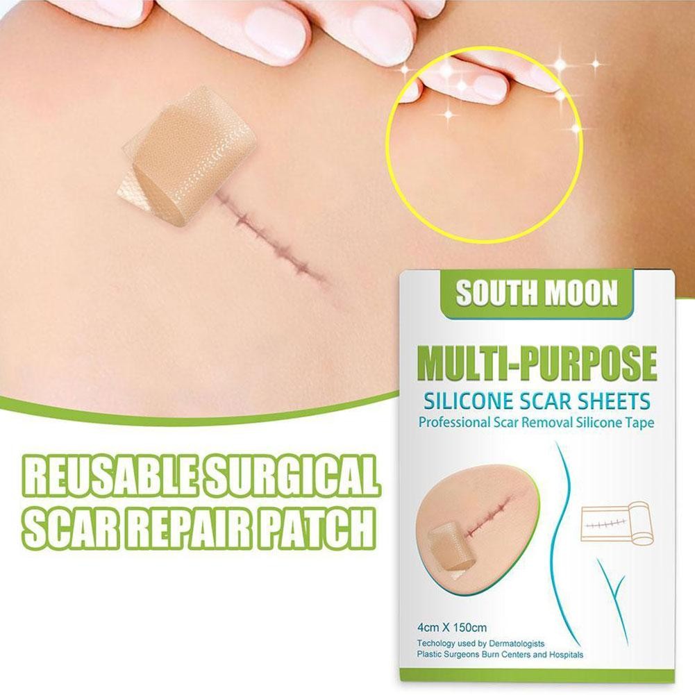 Silicone Scar Sticker Acne Gel Scar Sheet Scar Sticker | Shopee Philippines