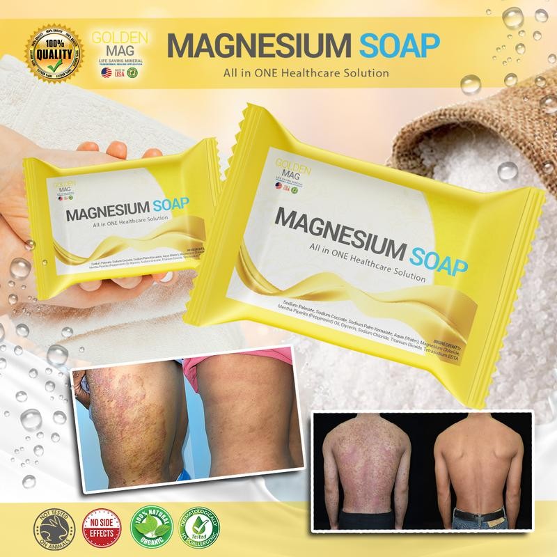 Magnesium Bar Soap (100g) for Skin Disease, Psoriasis, Eczema, Kati ...