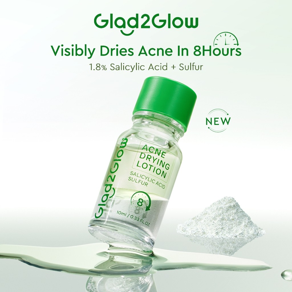 [8 Hours pimple Treatment] Glad2Glow Acne Drying Care Serum 10 ml Scar ...