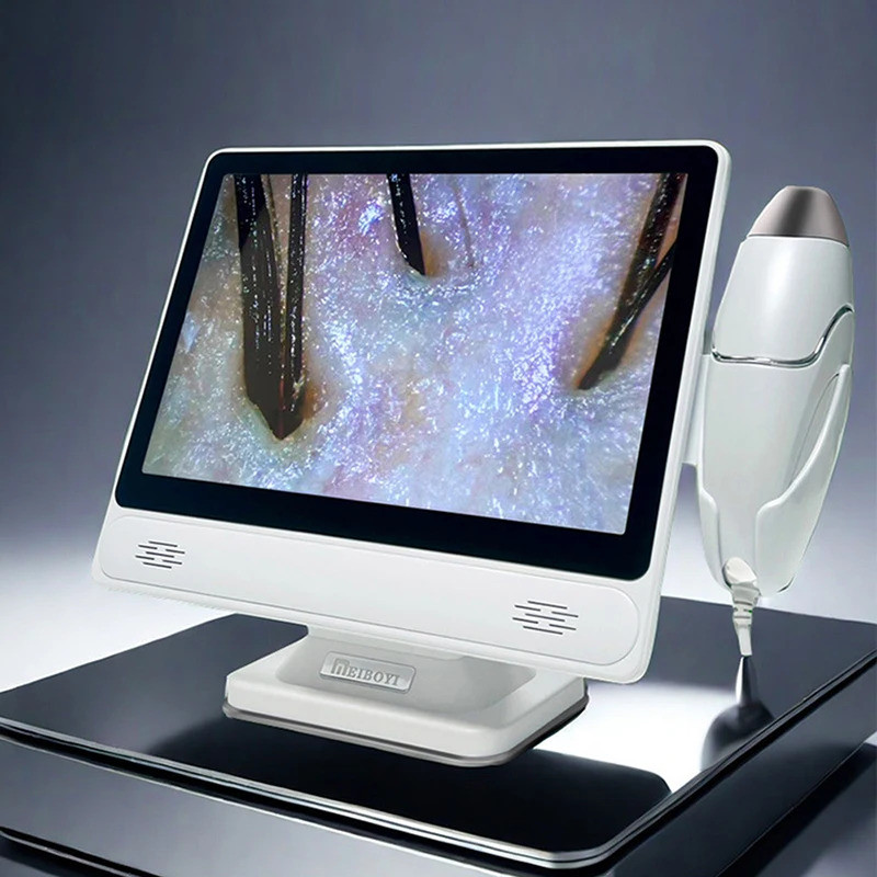 10 Inch HD Display Professional Hair Follicle Detector Scalp Diagnostic ...