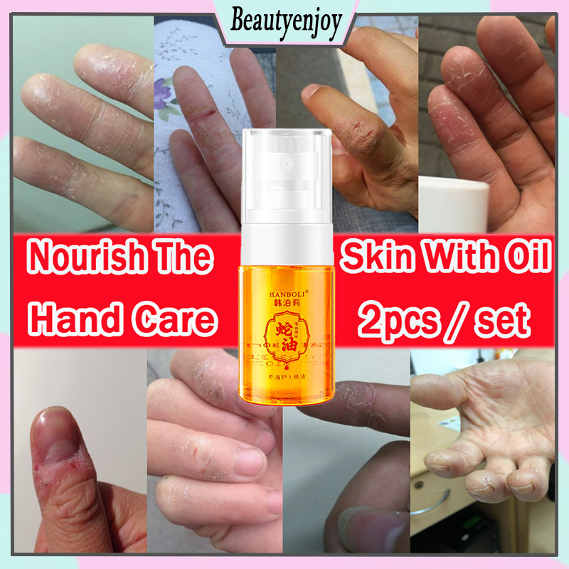 2pcs/set Snake Oil Hand Care Essential Oil Hand Care Cream Anti ...