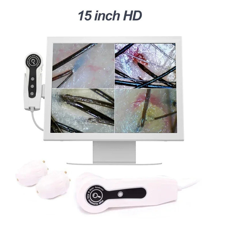 2024 HD Digital Skin Analyzer Professional Hair Scalp Camera Detector ...