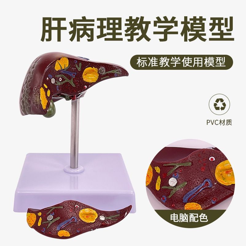 Good Quality Liver Patient Model Fat Model Liver Gallbladder Model ...