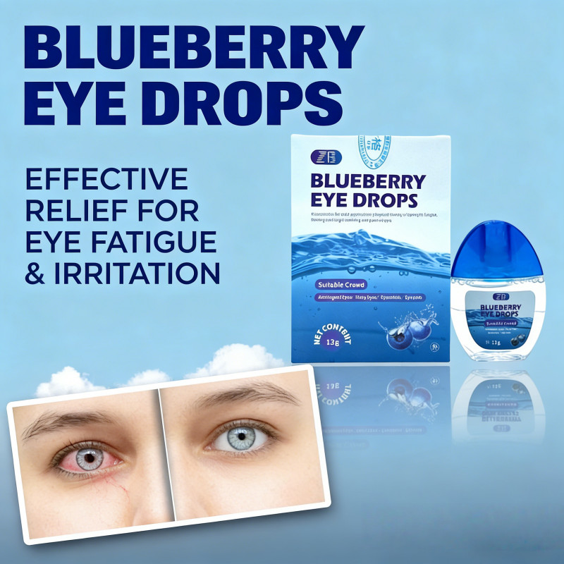 Shop eye drops for sore eyes for Sale on Shopee Philippines