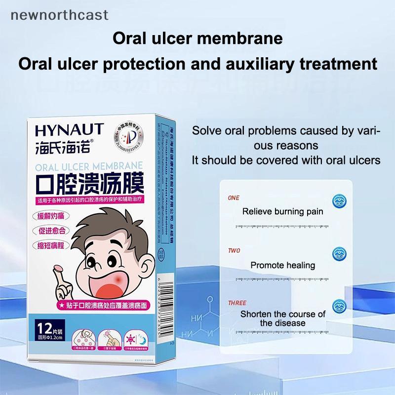 [newnorthcast] Quick Care Mouth Ulcer Patch Oral Mouth Wound Dressing ...