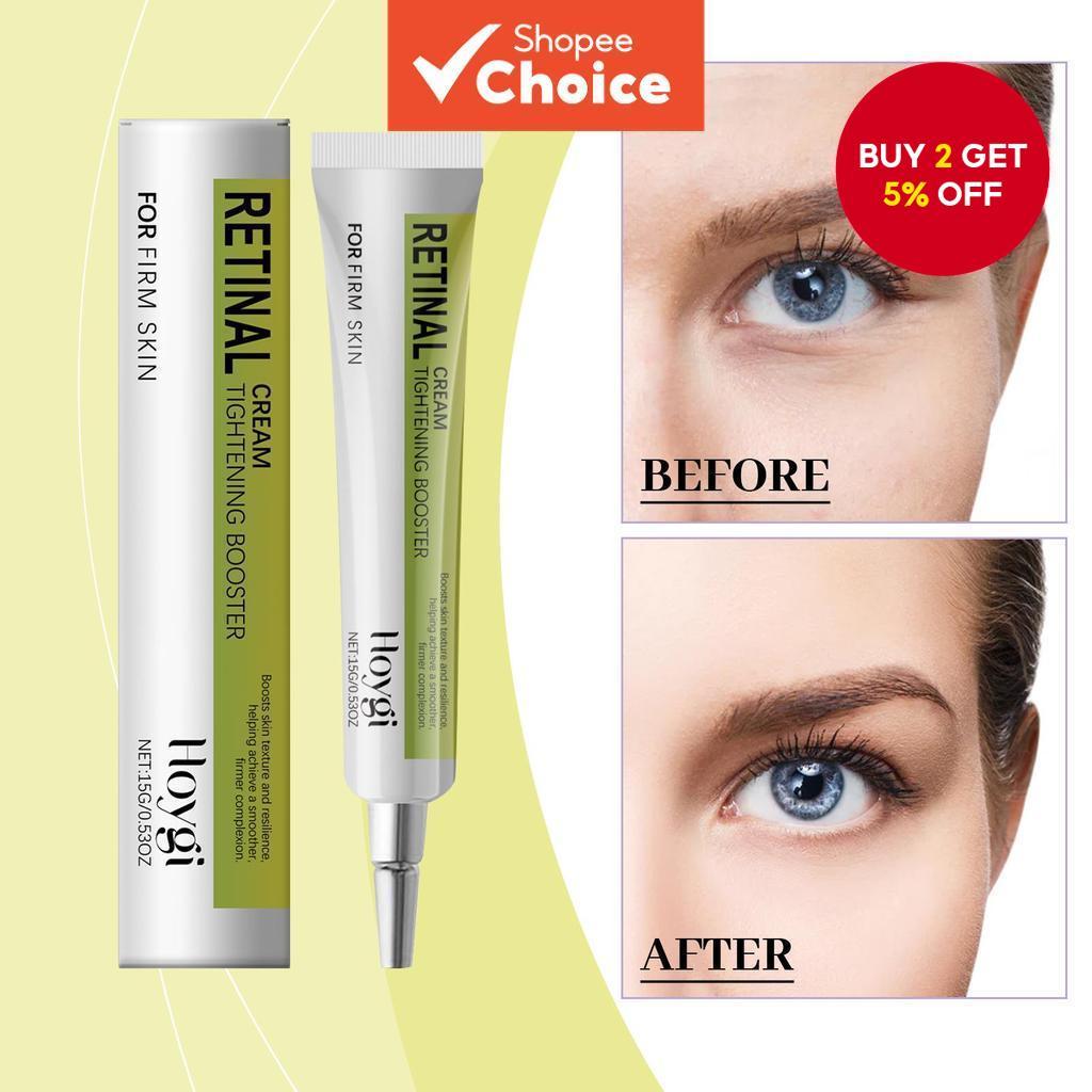 Retinal Eye Cream | Anti-Aging Moisturizers | Targets Dark Circles ...