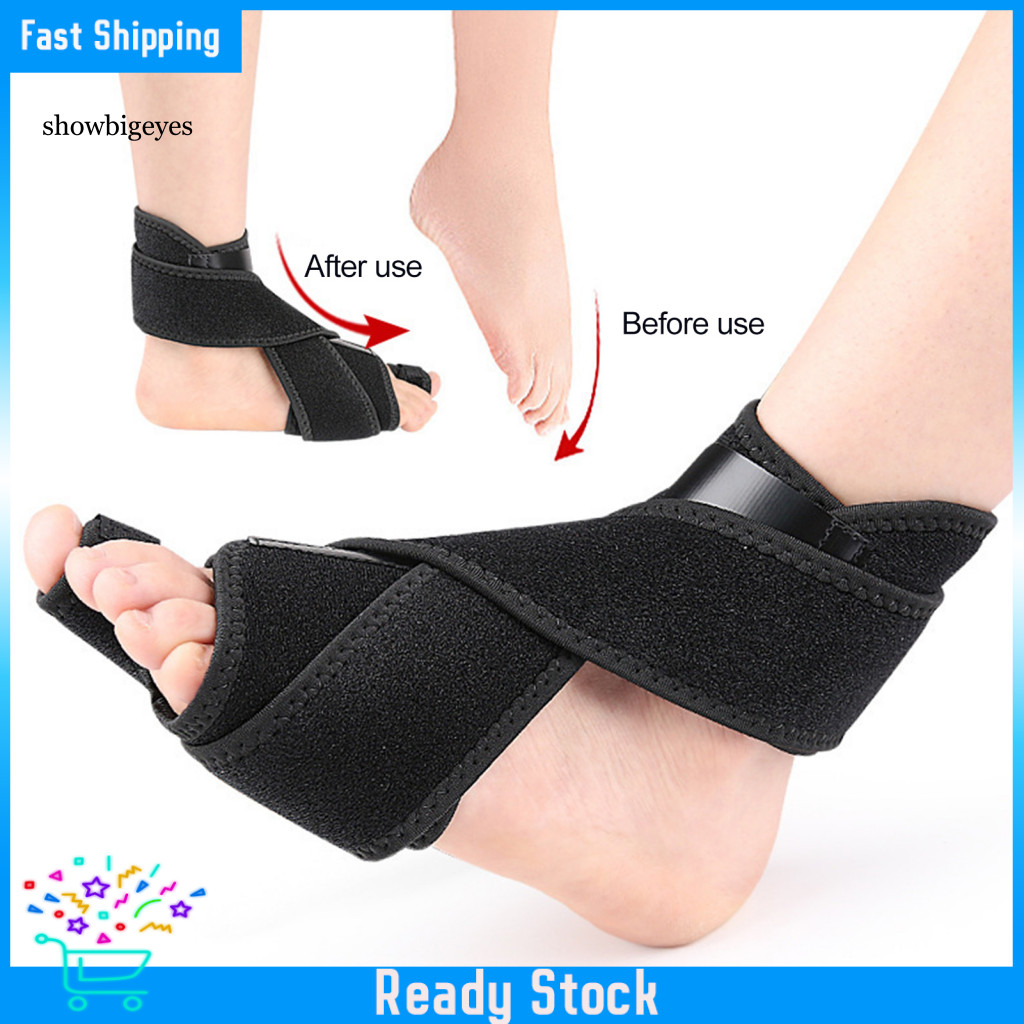SGES Realignment Aid Bunion Relief Device Adjustable Afo Foot Drop ...