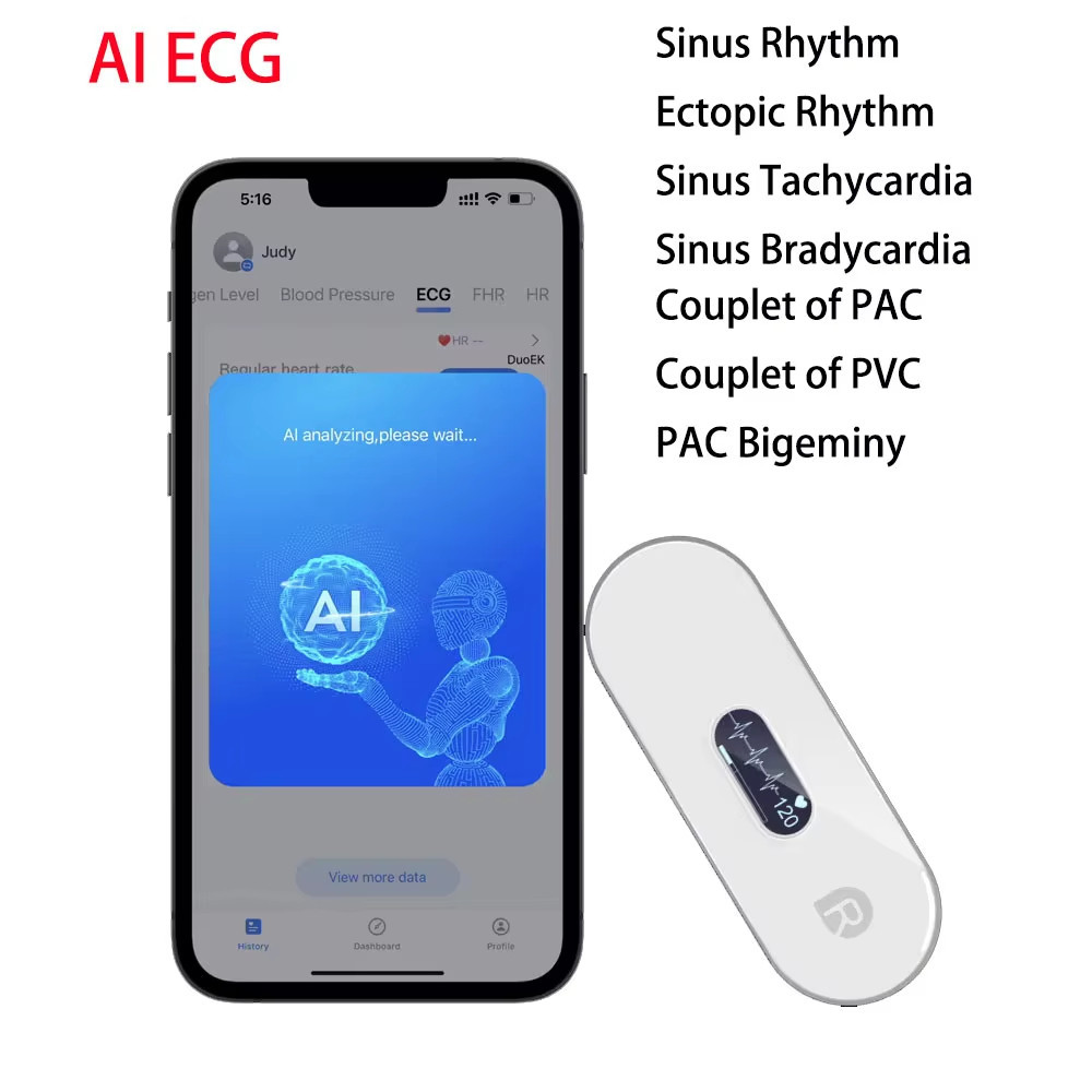 Bluetooth ECG Monitor With OLED EKG AI AnalysiArrhythmias Holter Heart ...