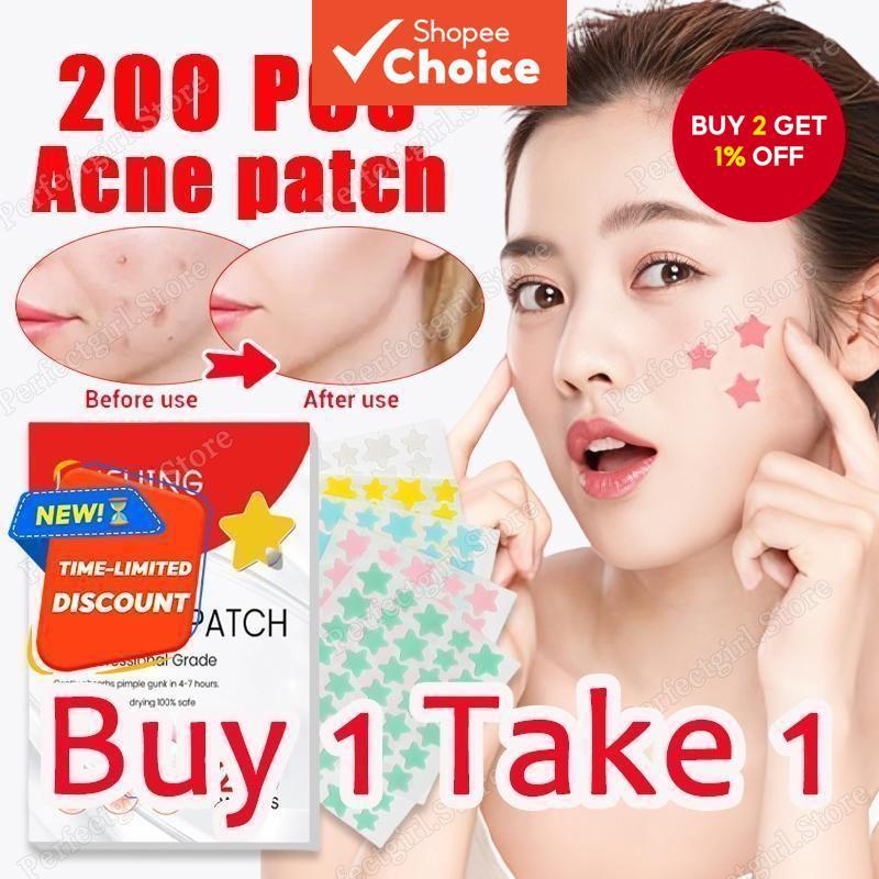 200Patches Star Shaped Acne Removal Pimple Patches Facial Care Stickers ...