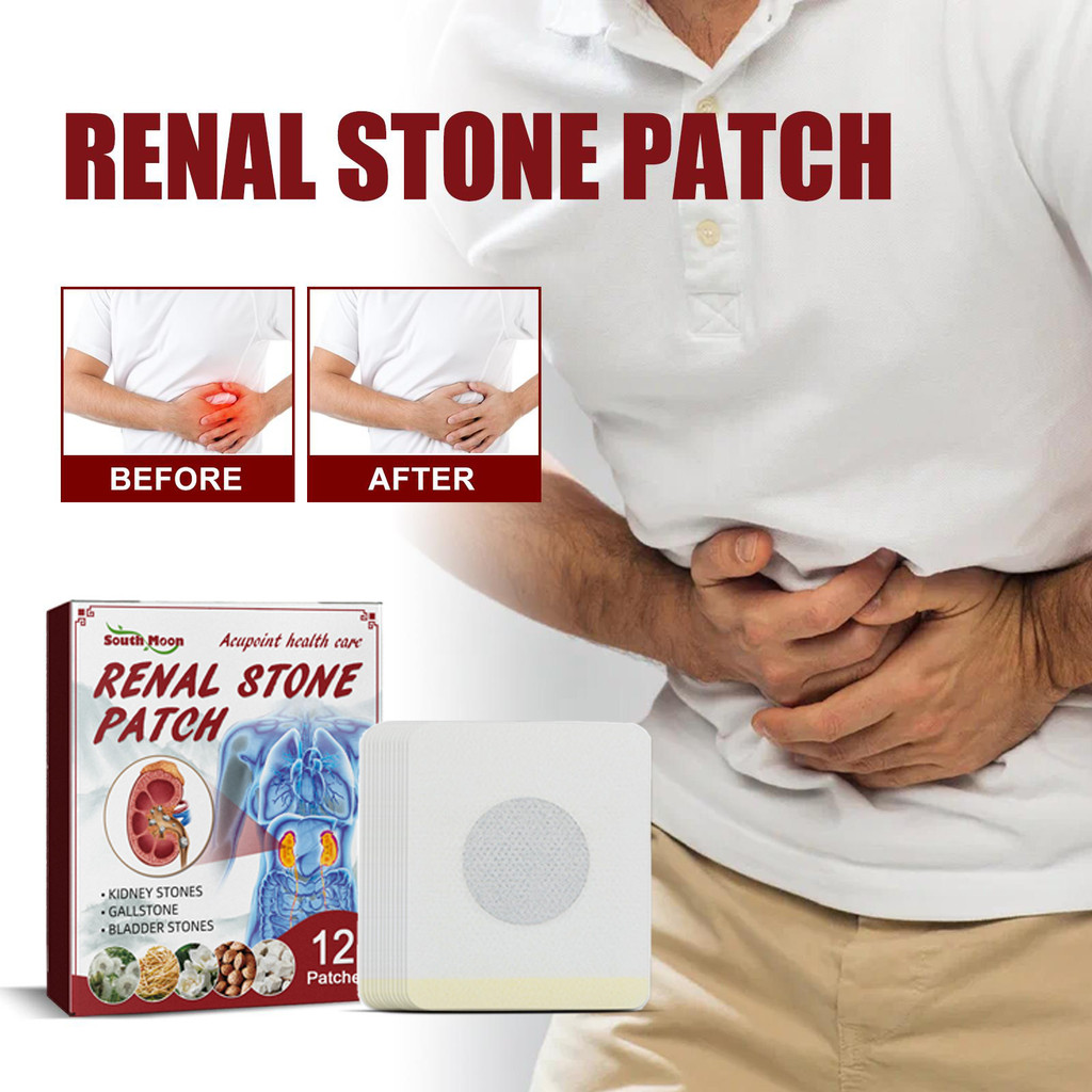 South Moon Kidney Stones Removal Patch Treat Gallstones Body Detox ...