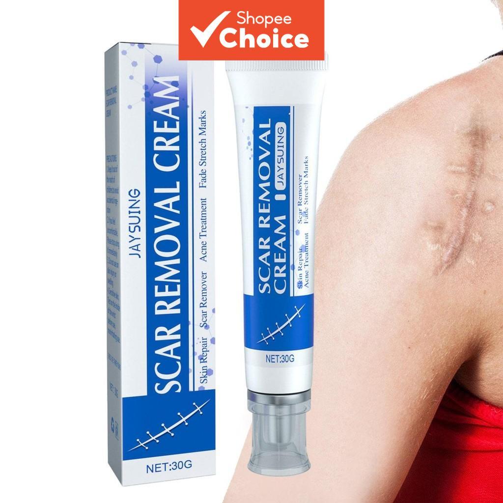 Scar Ointment, Medical Scar Cream, Advanced Scar Gel for Face and Body ...