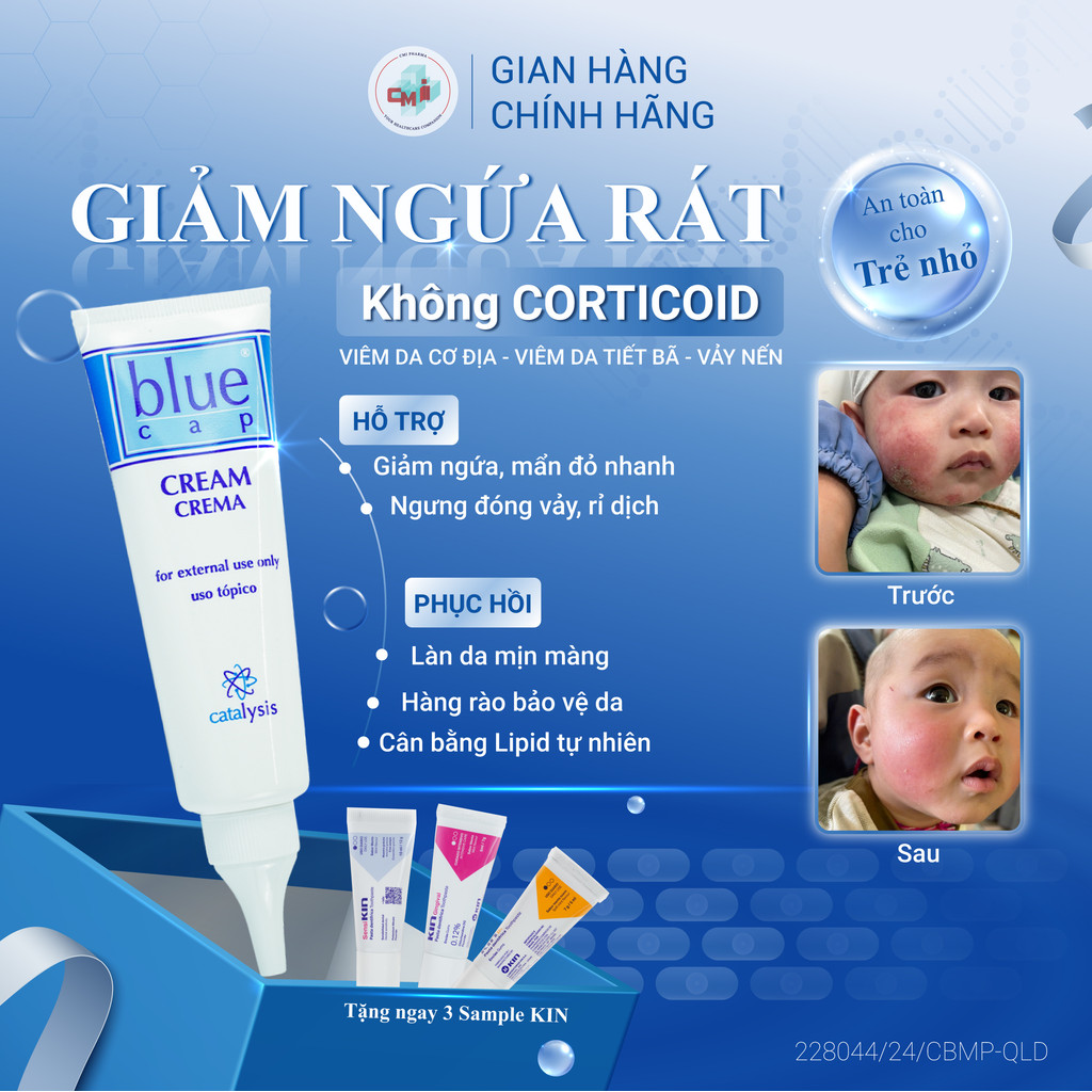 Blue Cap Cream 50g, Reduces Atopic Dermatitis, Allergic Dermatitis ...