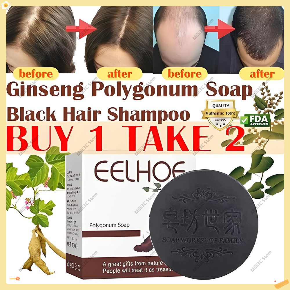 【BUY1 TAKE2】Hair Growth Soap Polygonum Soap Black Hair Anti Hair Loss ...