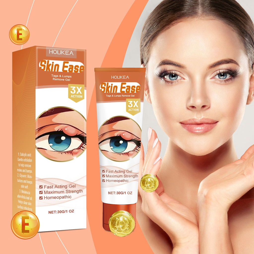 Stye Treatment Eye Ointment (30g) - Sterile Lubricant for Chalazion ...