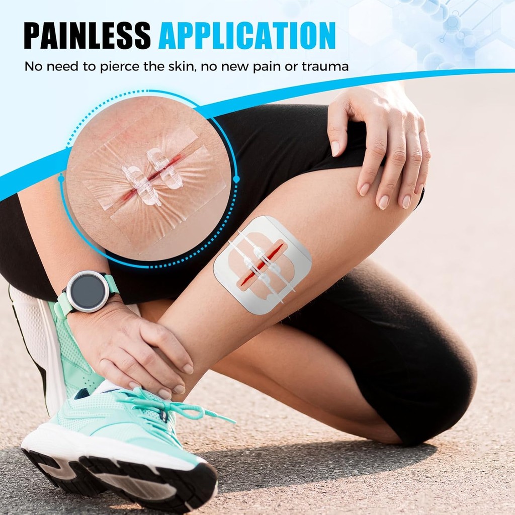 Wound Closure Strip Zip Stitch Emergency Laceration Closure Kit ...