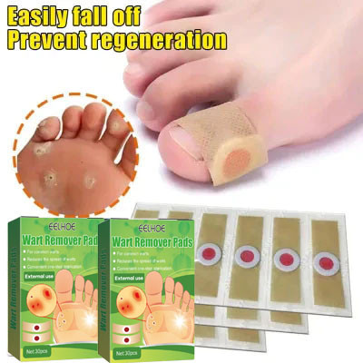 Wart Remover Foot Corn Remover Patch - Removes Calluses on the Feet ...