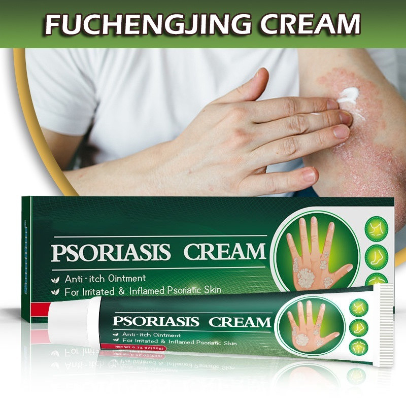 In stock & 20g Anti-Itch Ointment Body Psoriasis Dermatitis Pruritus ...