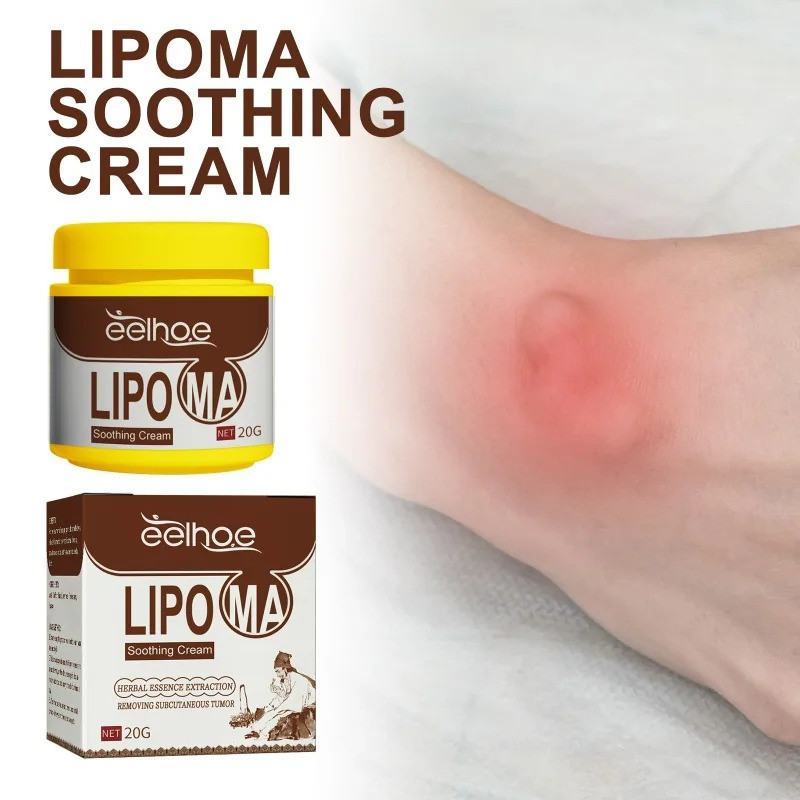 Lipoma Cream Subcutaneous Lumps Remover Treatment Medicine Liquid Apply ...