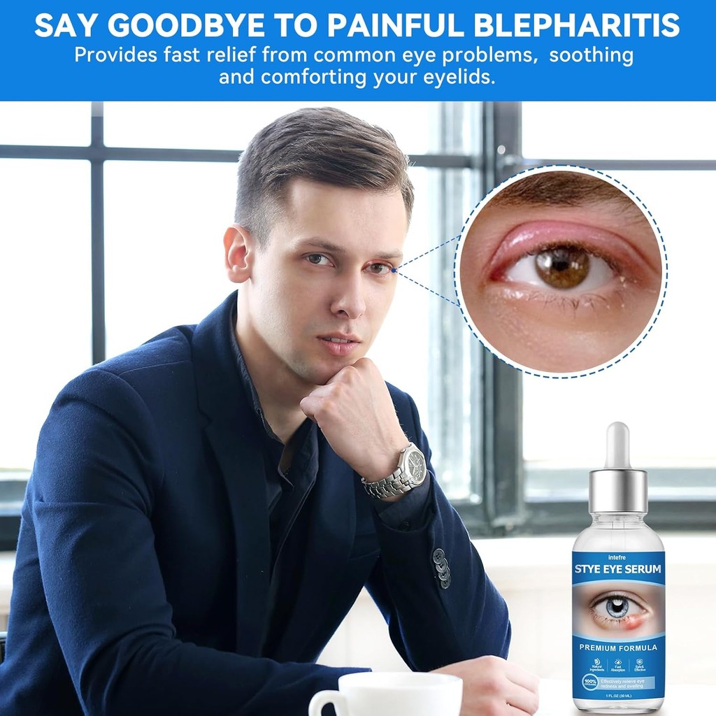 Stye Eye Treatment Drops, Eye Stye Remover for Stye, Chalazion ...