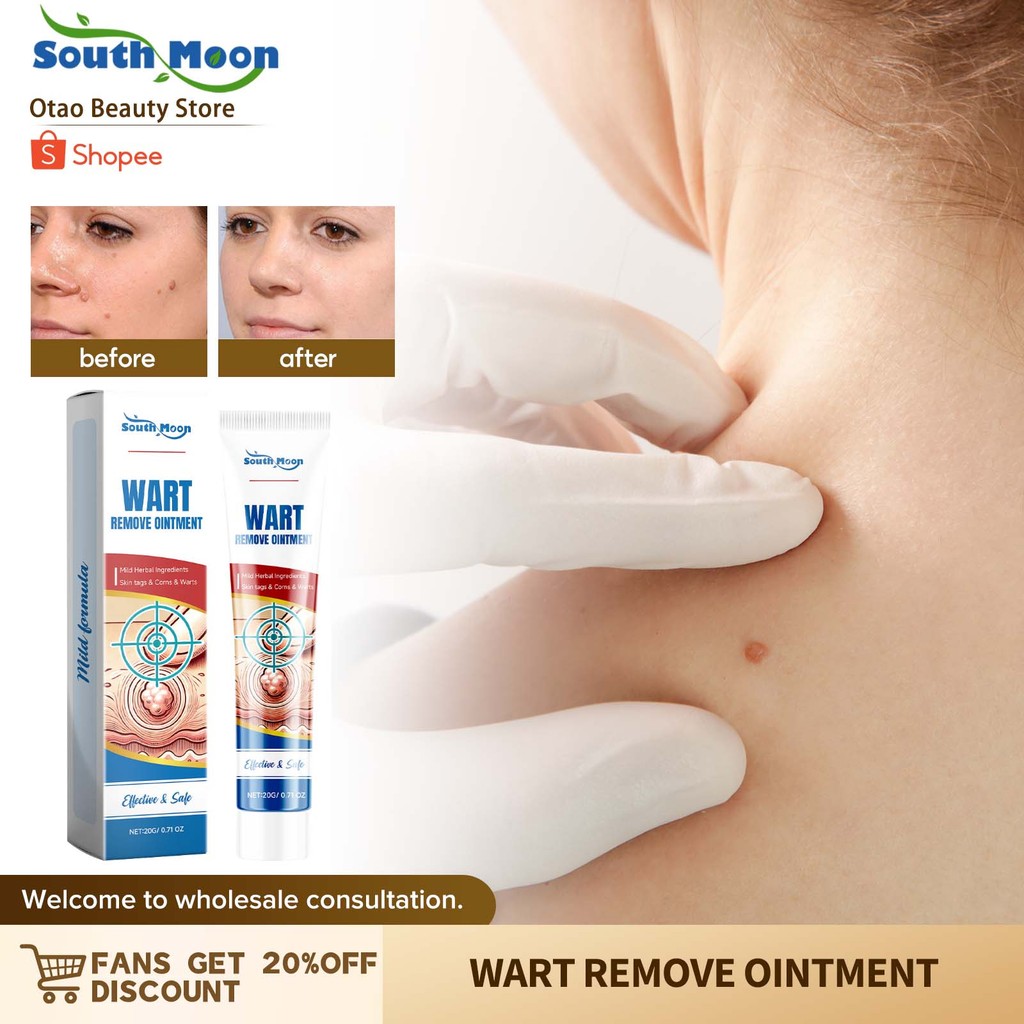 South Moon Wart Remove Ointment 20g Painless Mole Skin Dark Spot Warts ...