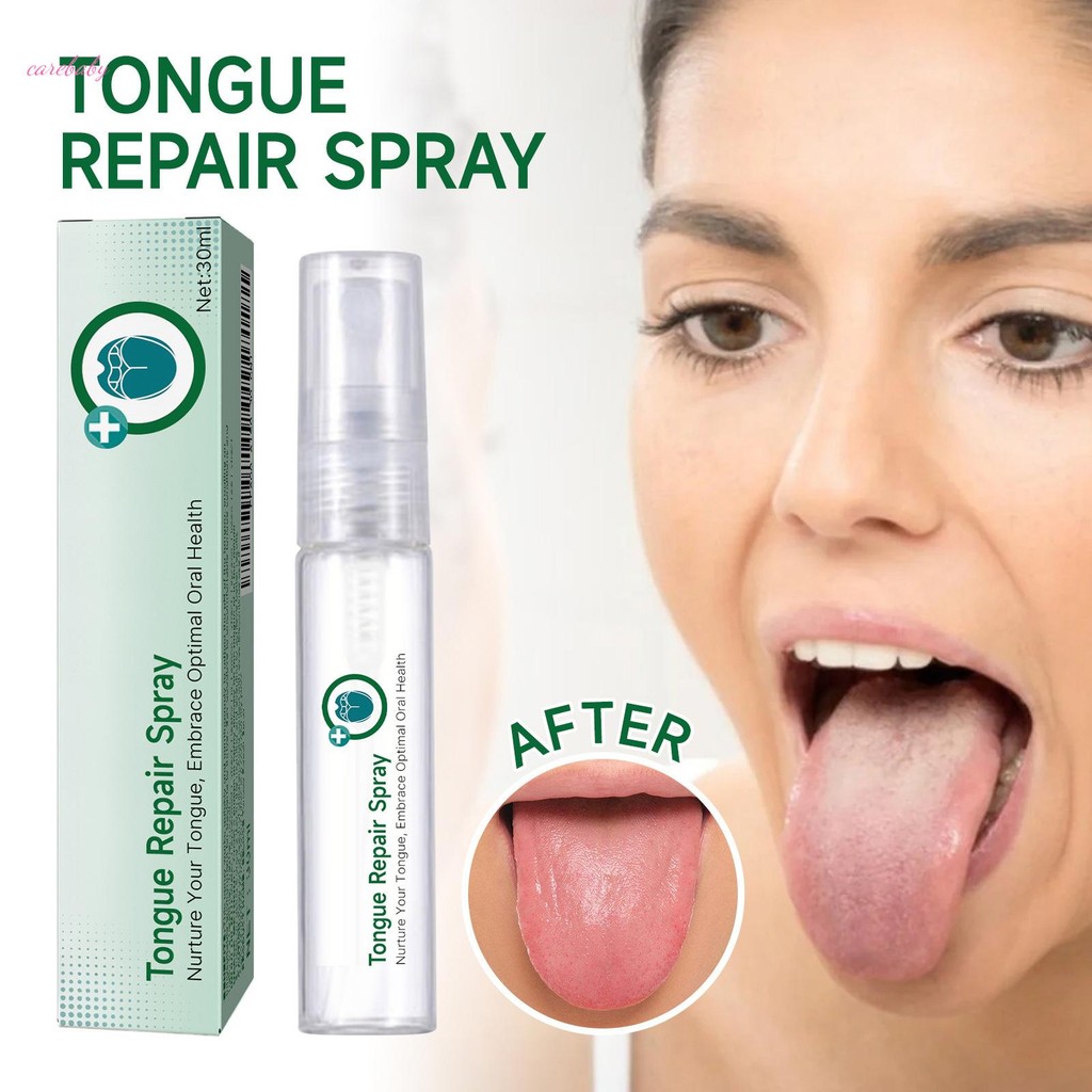 GlossShield Tongue Repair Spray 30ml For Cracked Tongue Relief And ...