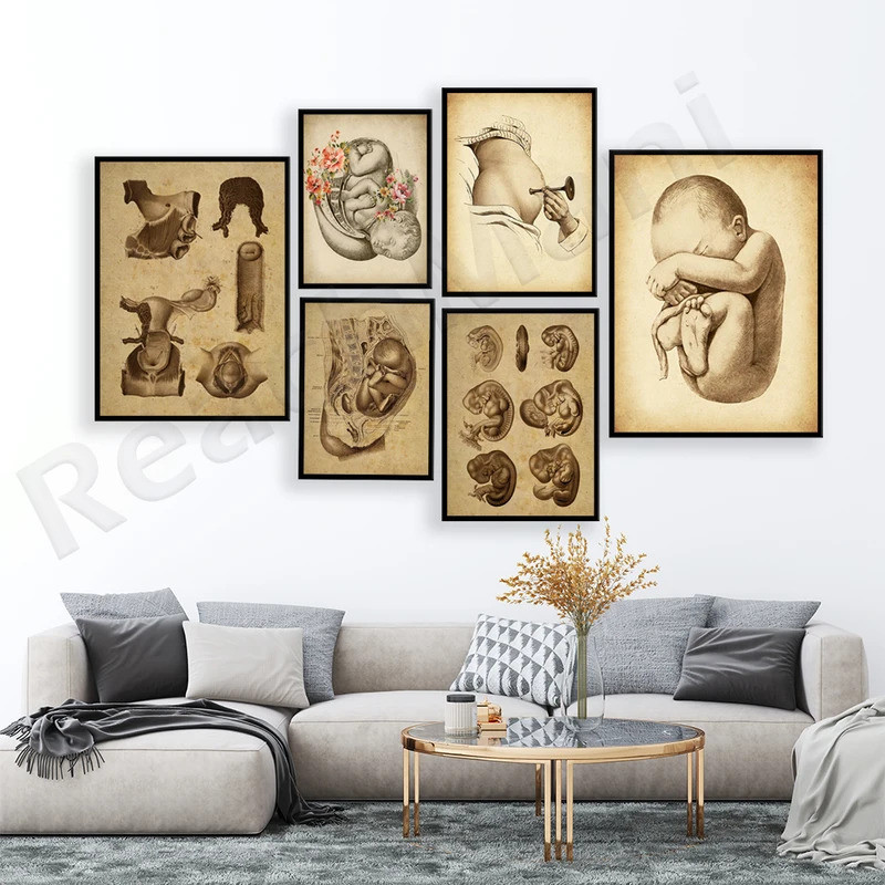 Obgyn Floral Poster, Fetus in Womb, Twin Babies, Placenta, Birth Art ...