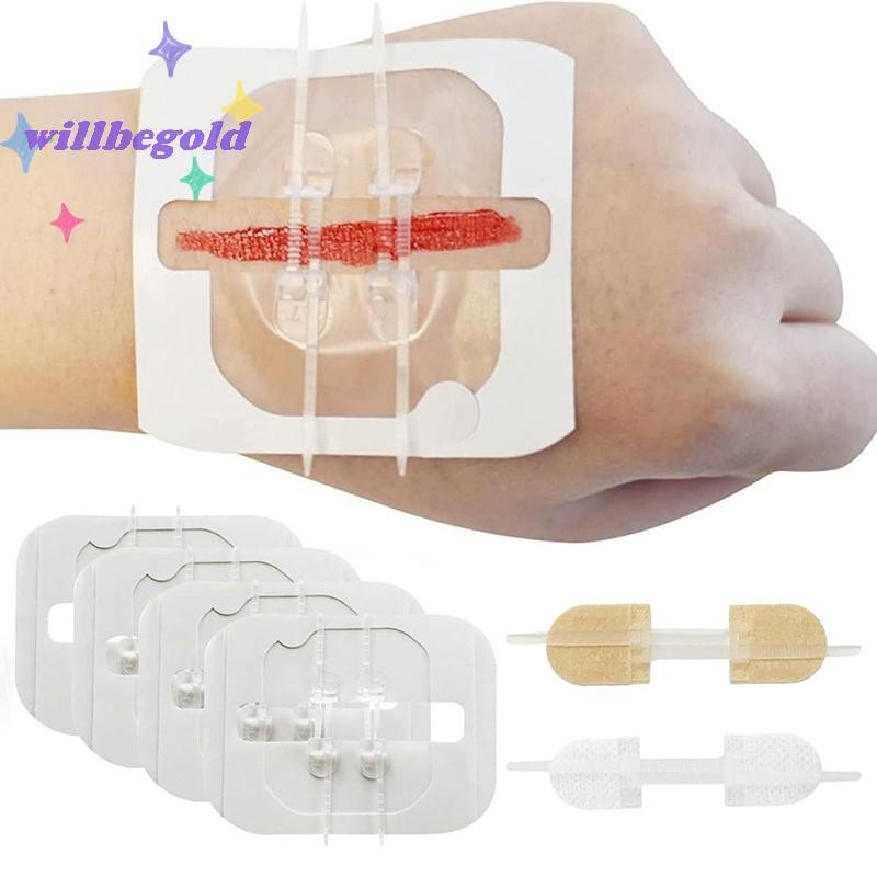 [WillBeRedP] 1/3/10/50 Patches Butterfly Closure Bandage Strips ...