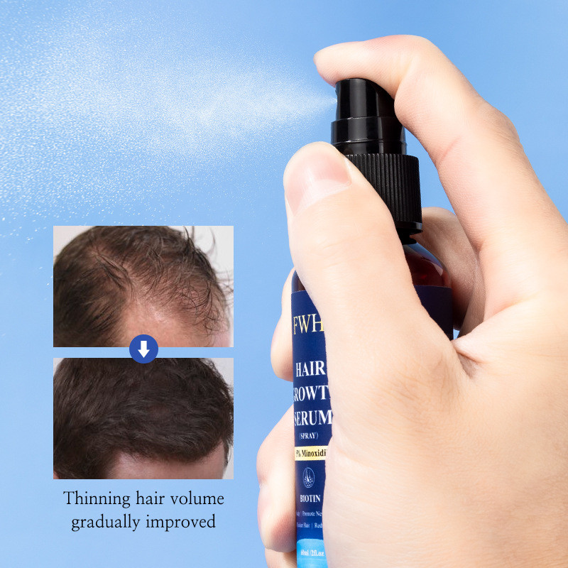 5%Minoxidil Hair Regrowth Spray - Deep Scalp Nourishment | Anti-Hair ...