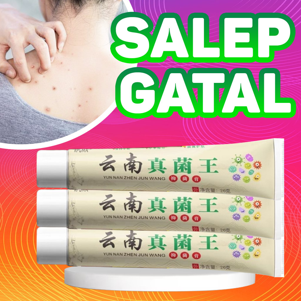 Yunnan Zhenjiu Wang Ointment Herbal Ointment for Treating Skin ...