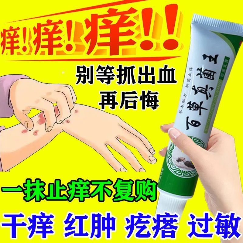2025 New Style Special Effects Skin Itching External Use Whole Body ...