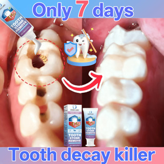 Repair tooth decay Anti-caries toothpaste Prevent tooth decay Deep ...