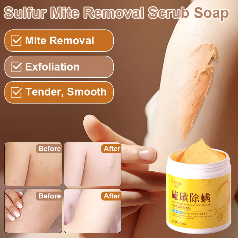 Refreshing Moisturizing Scrub Gentle Antibacterial Skin Improves ...