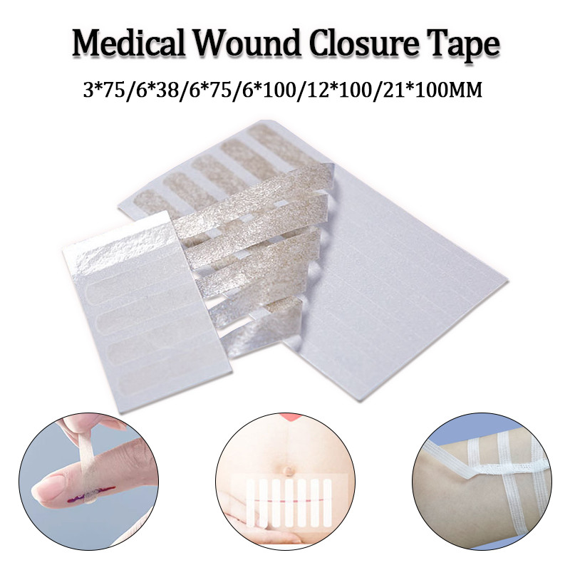 Wound Closure Tape Medical Sterile First Aid Adhesive Wound Dressing ...