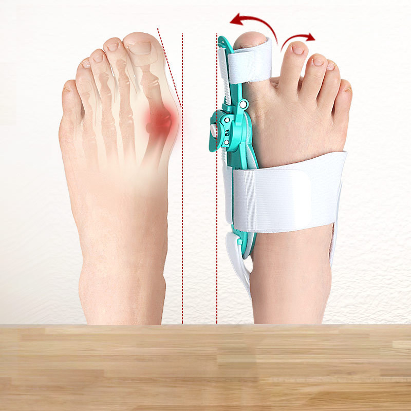Thumb Valgus Orthosis Big Foot Protrusion Overlapping Toe Toe Separator ...