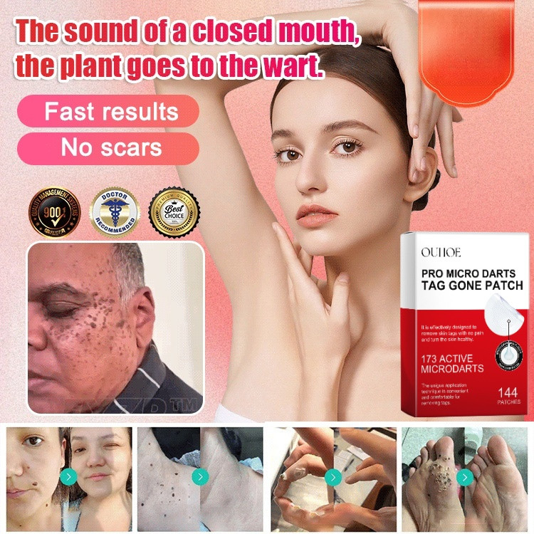 144pcs/box[Quickly Remove Warts] Plant Wart Removal Patch/Skin Repair Cleansing and Maintenance ...