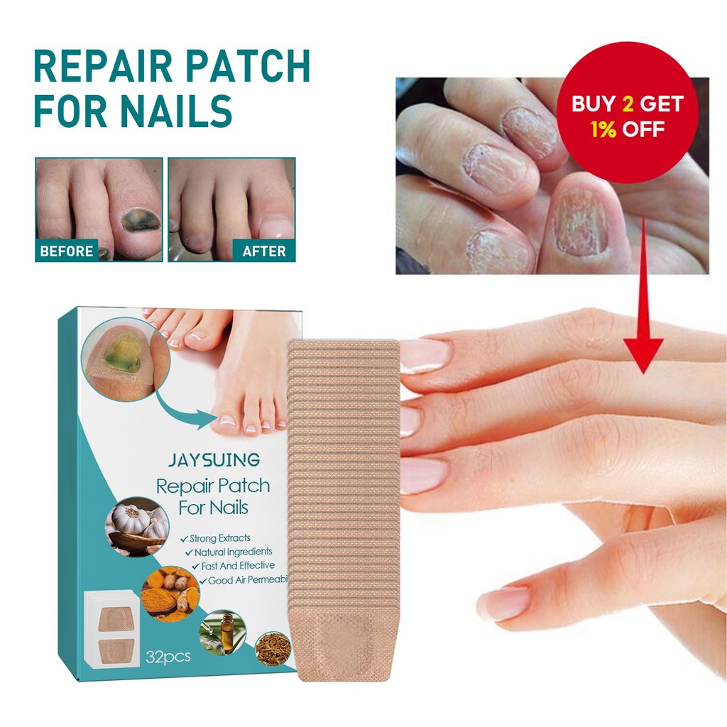 Embedded Nail Patch Anti Fungal Paronychia Yellowing Thickening Nails ...