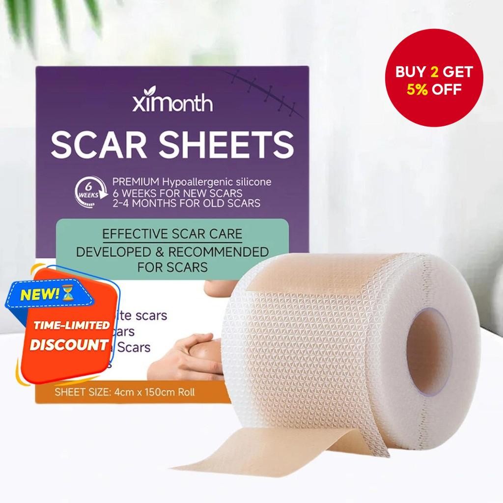 Silicone Scar Sheets - Patches to Reduce Scars, Redness, and Irritation ...