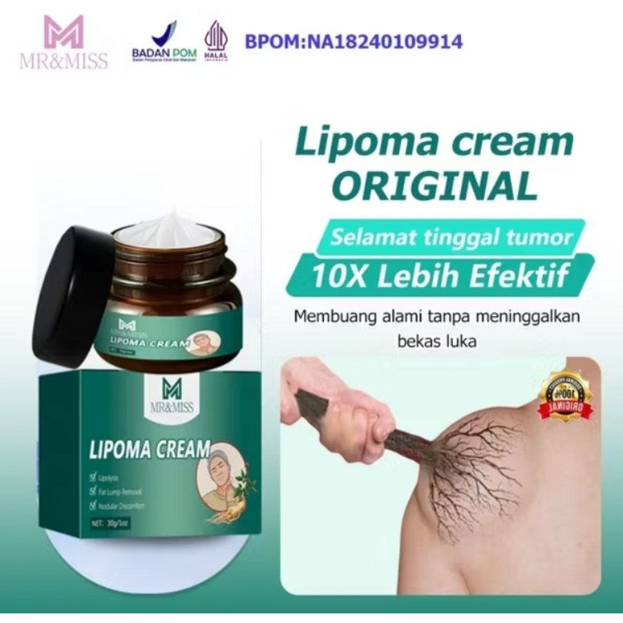 Lipoma Cream 100% Original Lipoma Ointment Lump Ointment Lipoma Lump ...