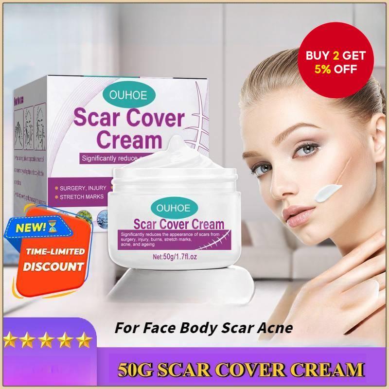 Scar Cover Cream for Face and Body - Acne Scar, Stretch Mark, and Skin ...